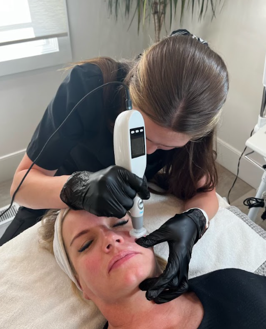 Jet Plasma – Fluent Skin Health